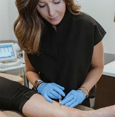 Asclera® Vein Treatment in Bellingham, Burlington & Bothell ...